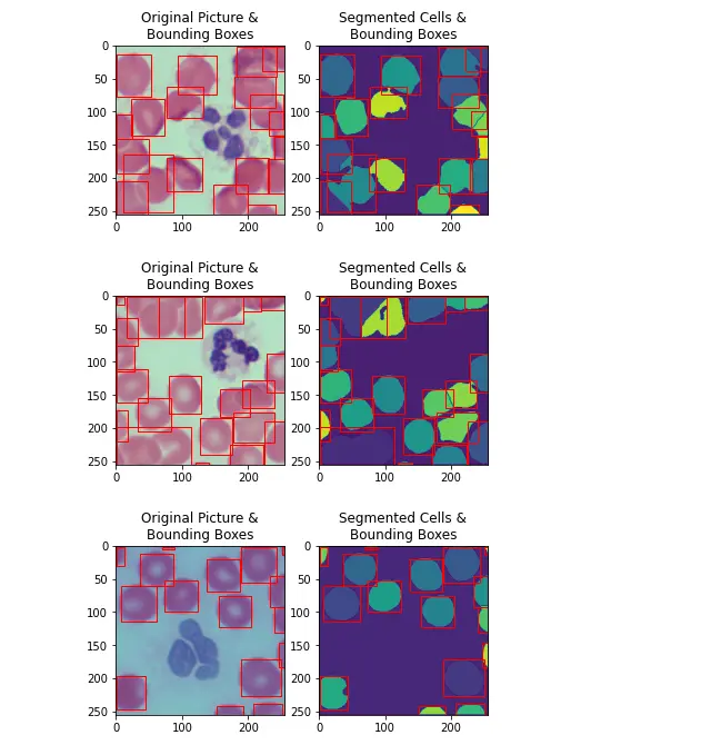 Ml Guide On Cell Segmentation Using Watershed Algorithm